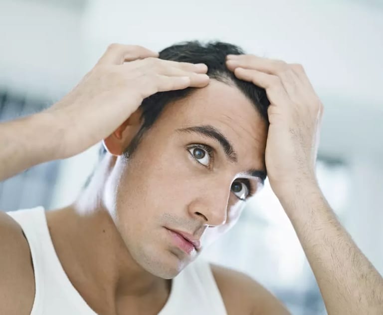 Men Hair Loss Sunshine Cosmetic Clinic Medi Spa men-hair-loss-sunshine-cosmetic-clinic-medi-spa