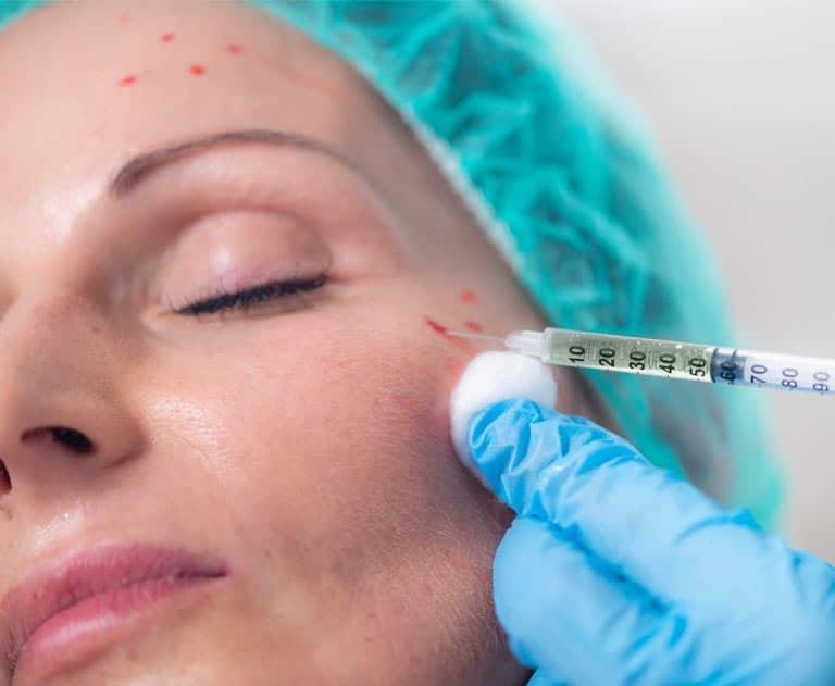 vampire-facial - Sunshine Cosmetic Clinic & Medi Spa