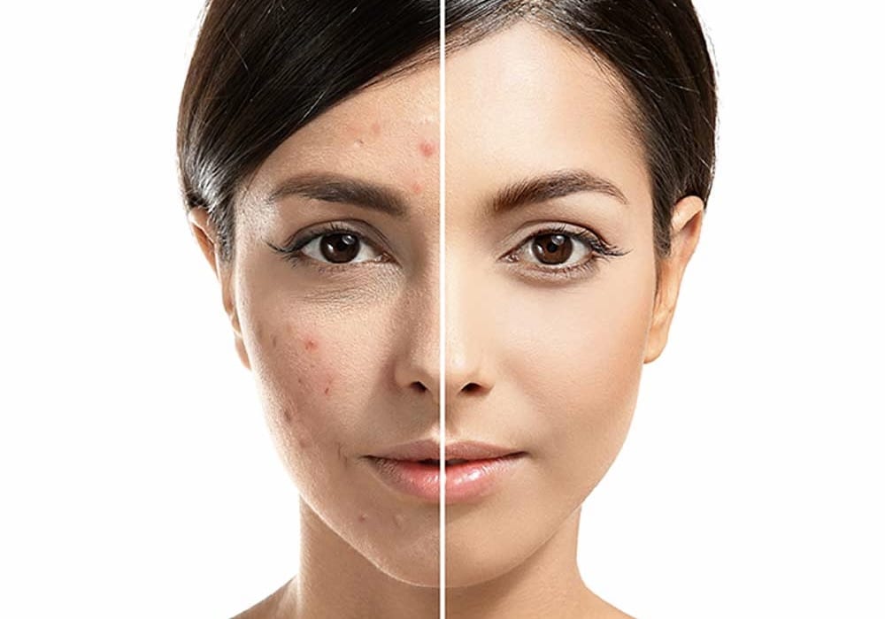 No 1 Facials Waterloo, Kitchener, Cambridge | Best Facial Near Me