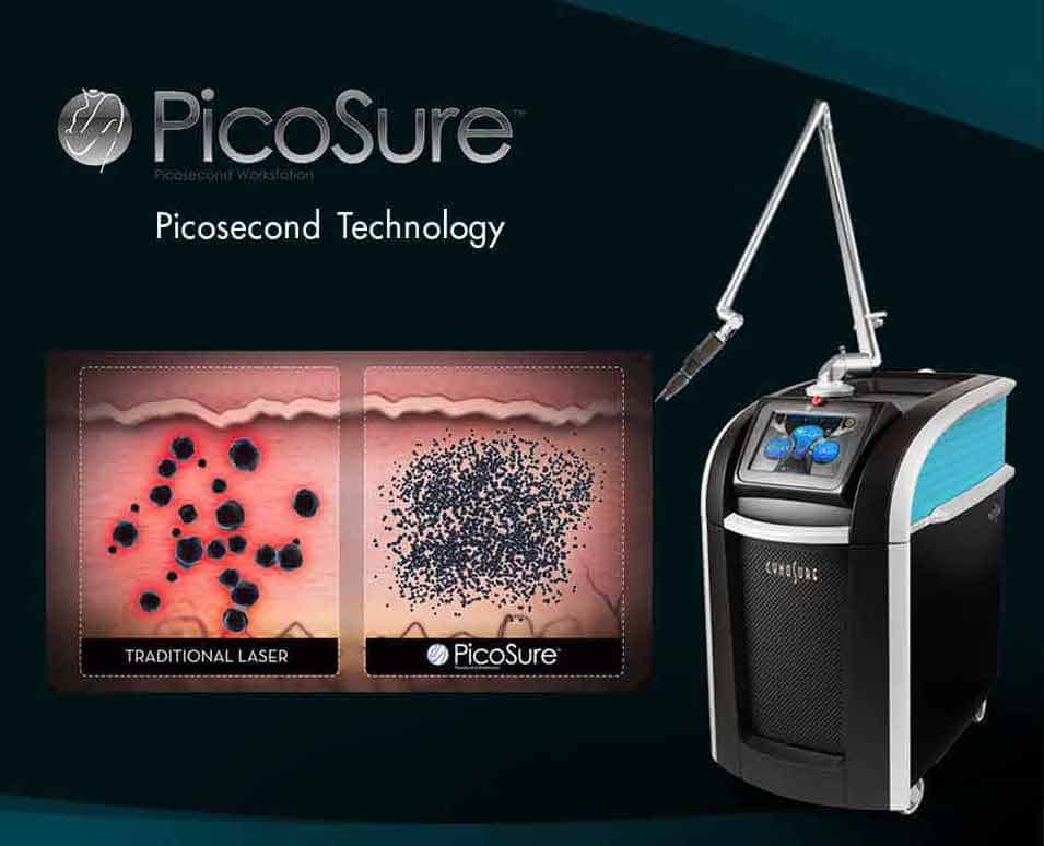 PicoSure Skin Rejuvenation Kitchener, Waterloo, Cambridge
